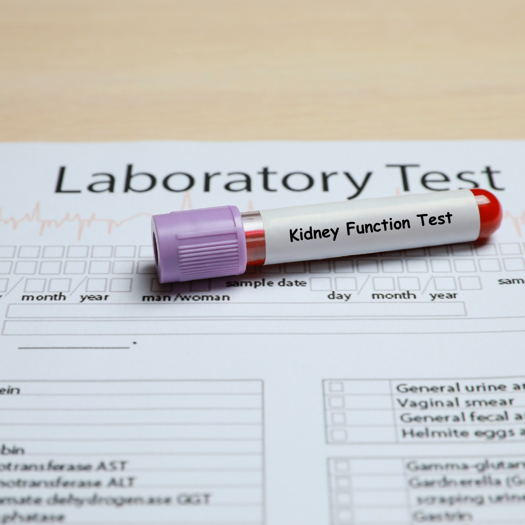Kidney Function Test ChemHealth Diagnostics Kidney Function Test ChemHealth Diagnostics